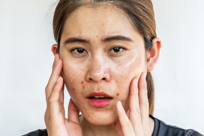 Cách Làm Đẹp Da Mặt Đơn Giản - Bí quyết trẻ hoá làn da